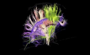 Annie Hopper – DNRS Online Instructional Video Program - Wisdom Library