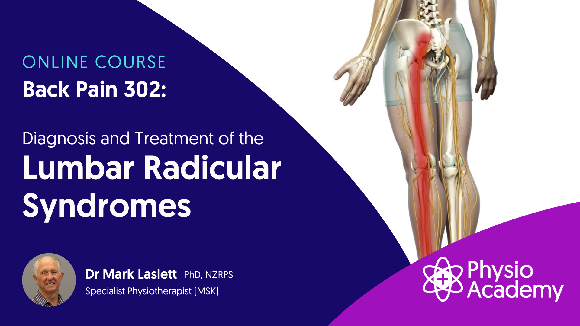 Mark Laslett - Back Pain 302 - Diagnosis and Treatment of the Lumbar Radicular Syndrome - Wisdom ...